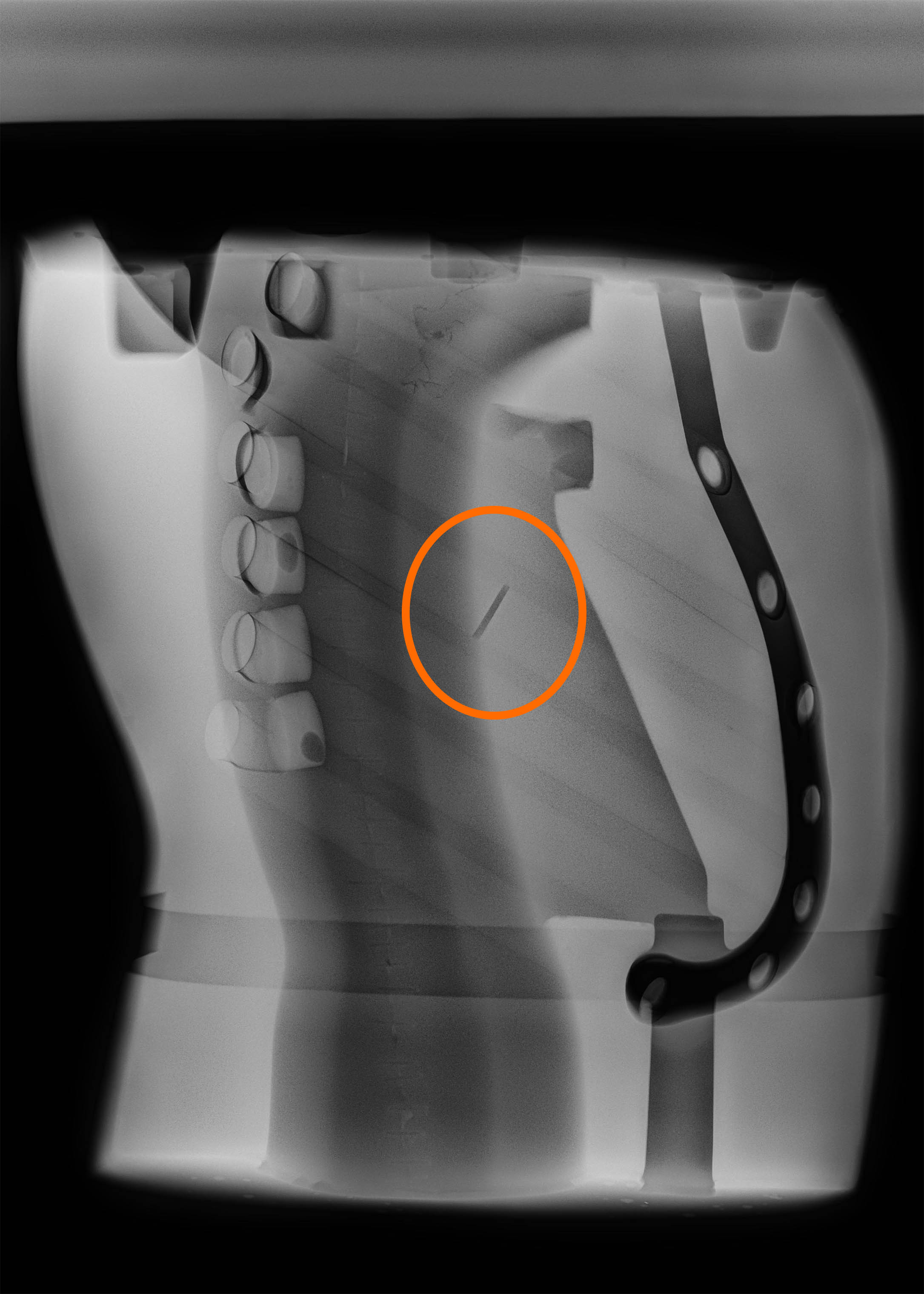 Customized Dummys - Biofidelic dummy - ATD-Dummy | CTS | crashtest ...